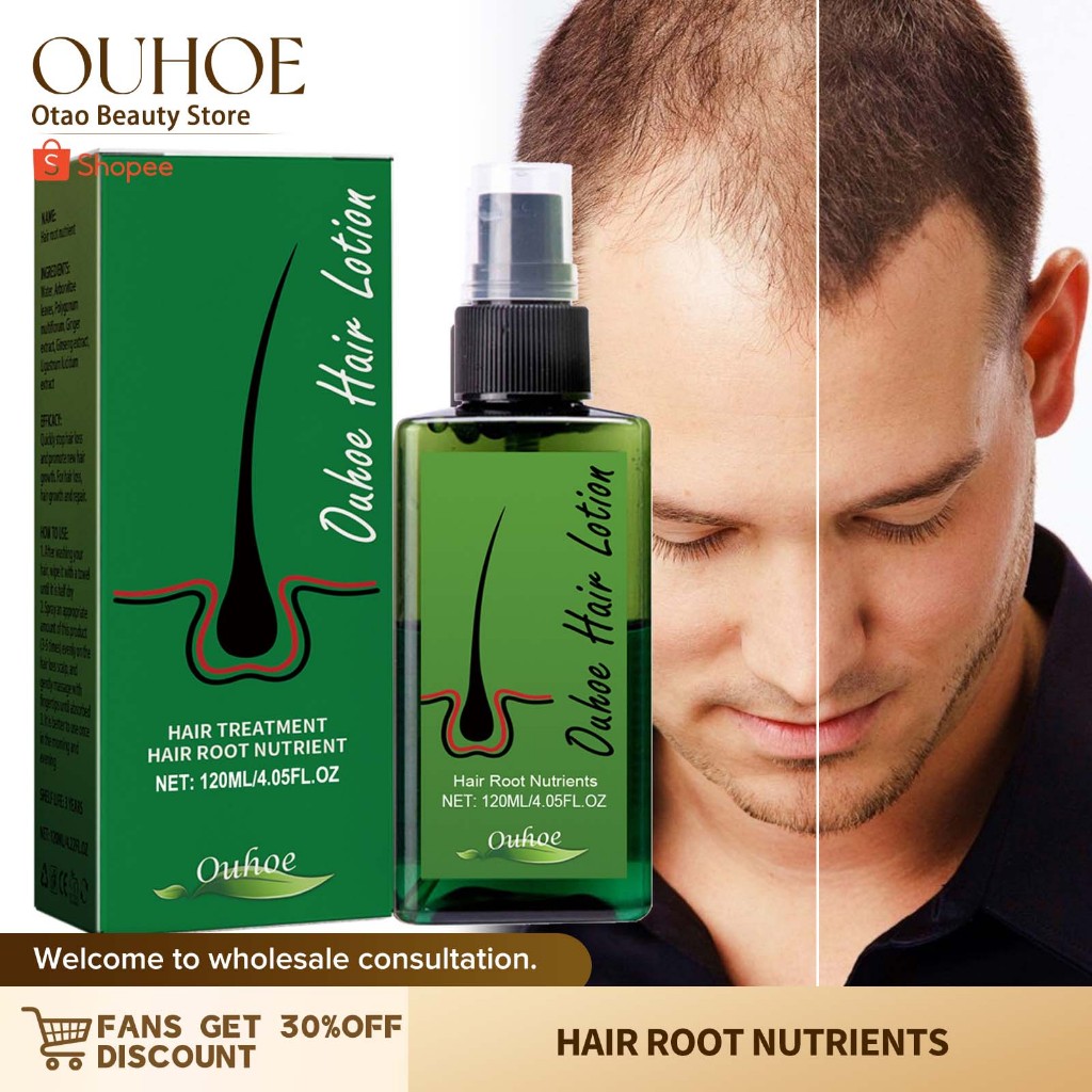 OUHOE Hair Growth Spray Anti Hair Loss Baldness Hair Root Repair ...