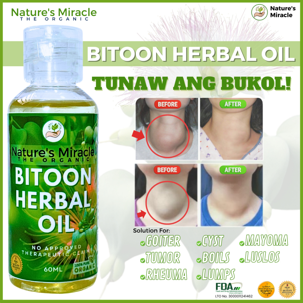 Bitoon Herbal Oil Original Buy 1 Take 1 For Bukol Pang Tunaw ng Bukol Goiter Cyst Myoma ...