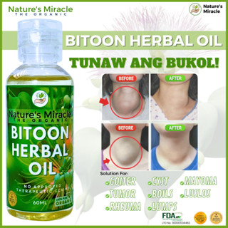 Bitoon Herbal Oil Original Buy 1 Take 1 For Bukol Pang Tunaw ng Bukol ...