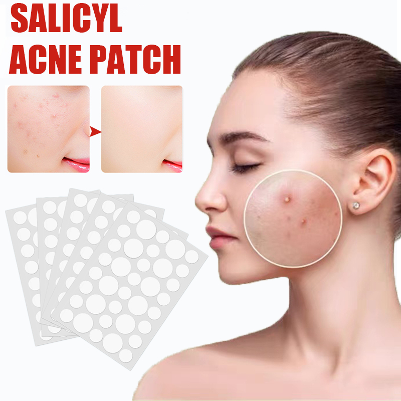 36PCS/Sheet Acne Pimple Patch Salicylic Acid Acne Treatment Stickers ...