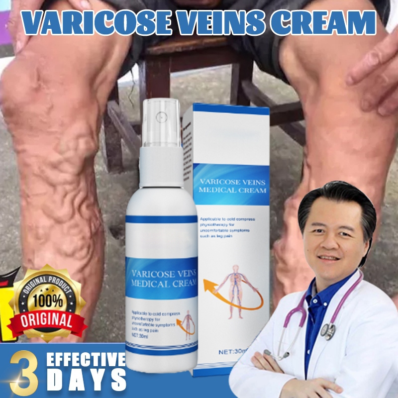 Varicose Vein Remover Spray Original Varicose Veins Treatment Spider ...