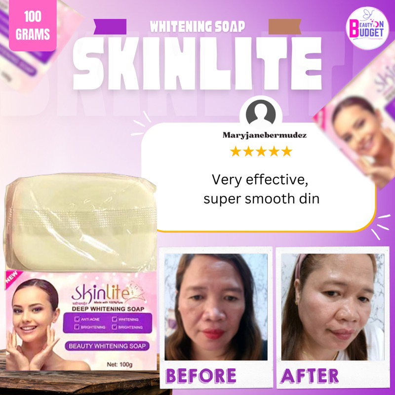 EXP DATE: 05/30/2026 | SKINLITE Beauty Whitening Soap Pekas Remover ...