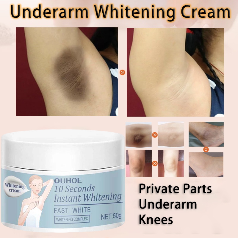 10Seconds Instant Whitening Cream Private Parts Underarm Whitening ...