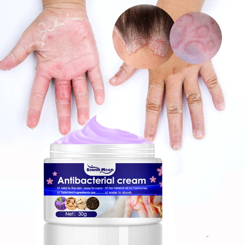 Anti Fungal Cream Private Antibacterial Ointment For Itchy Skin A ...