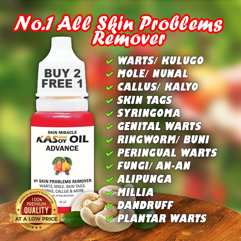 No.1 Warts Remover, Kulugo, Skin tag, Mole/Nunal, Kalyo, More ...