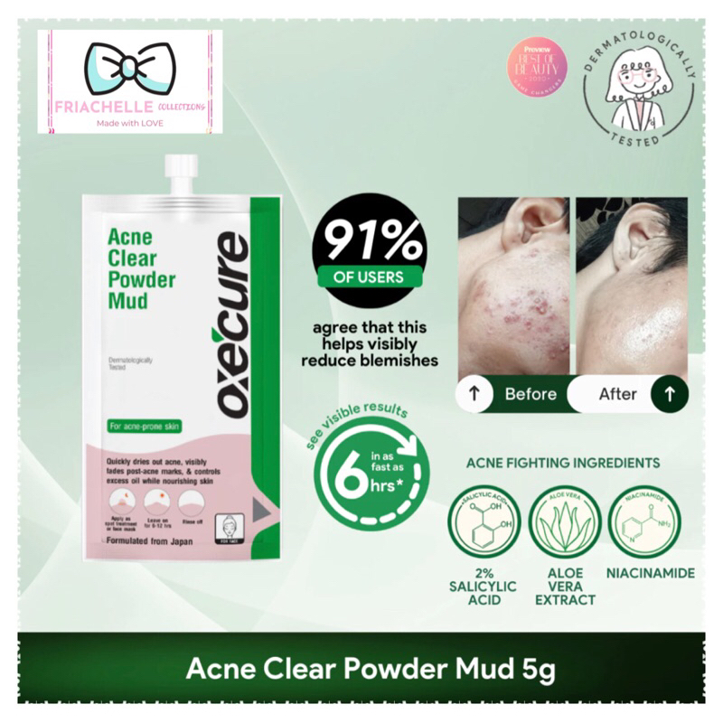 OXECURE acne clear powder mud 5g 1pc authentic | Shopee Philippines