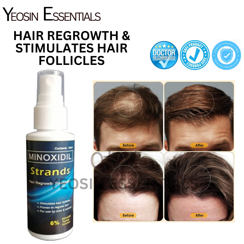 Minoxidil Strands 6% Minoxidil Topical Solution Hair Beard Grower Women ...