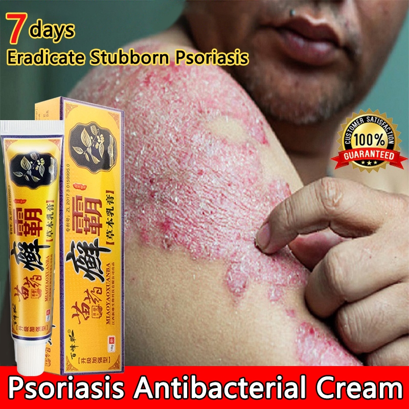 Eczema Psoriasis Treatment Ointment Antibacterial Psoriasis Herbal