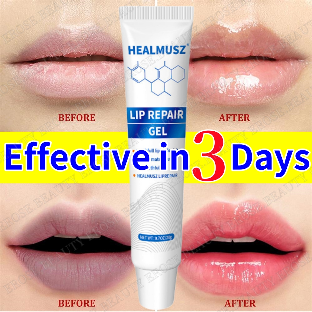 Lip Repair Care Scrub Lip Therapy Balm Lip Exfoliator Remove Lip Dead ...