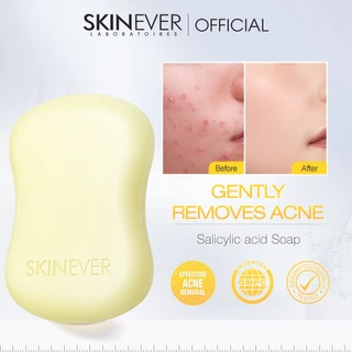 SKINEVER Official Store PH, Online Shop | Shopee Philippines