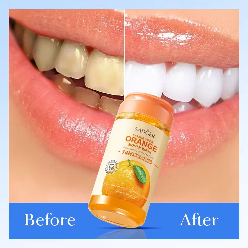 SADOER Soda Oral Rinse Antibacterial Lasting Fresh Mouthwash Bad Breath ...