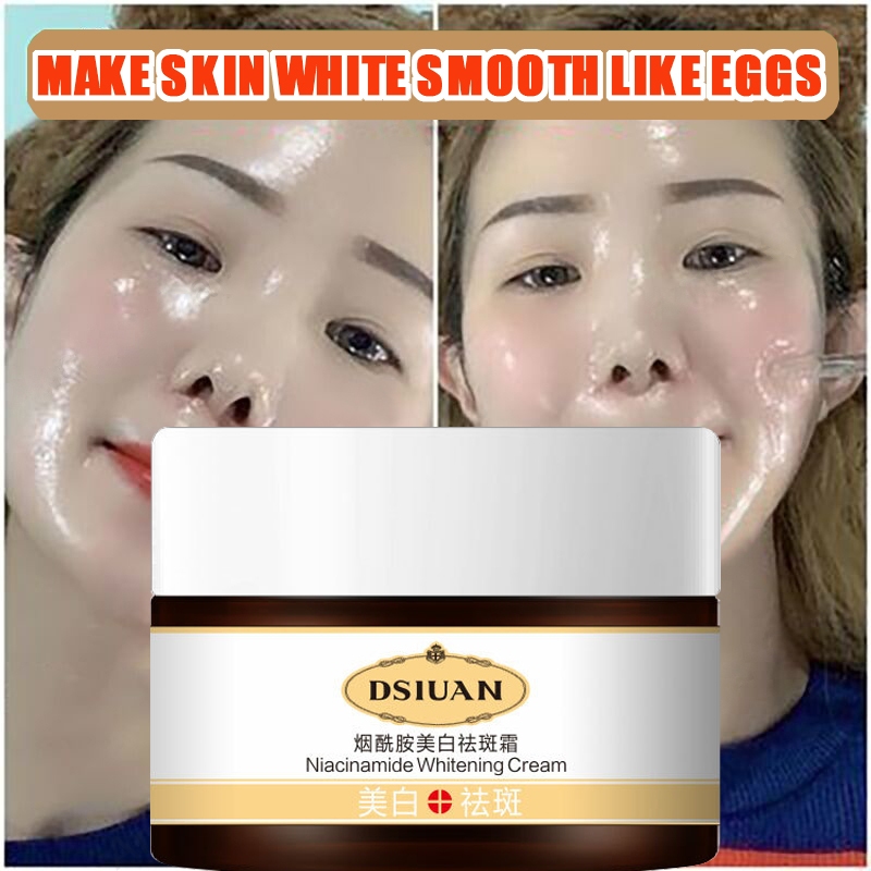 Melasma Cream Pekas Remover Anti Freckle Remove Melanin Lighten Dark ...