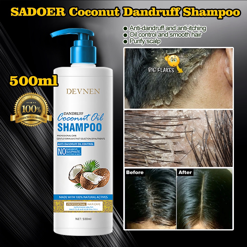 DEVNEN Coconut Oil Shampoo Anti Dandruff Repair Damaged Dry Frizz Hair Oil Control Refreshing ...
