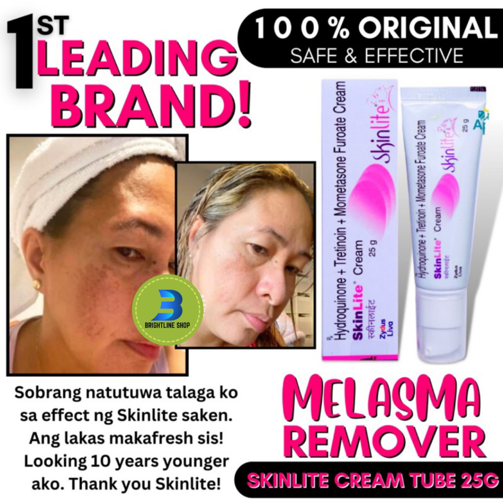 Skinlite Melasma Whitening Cream, 25g from Dubai for Melasma, Skin ...