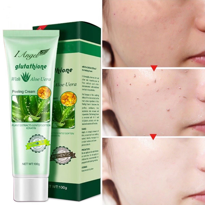 I Angel Glutathione with Aloe Vera Magic Peeling Cream Exfoliate 100g ...