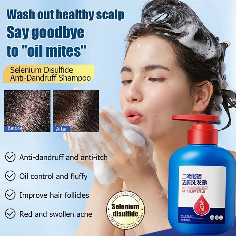 Selenium Sulfide ANTI-DANDRUFF SHAMPOO EXTRA MOISTURIZING 300ml ...