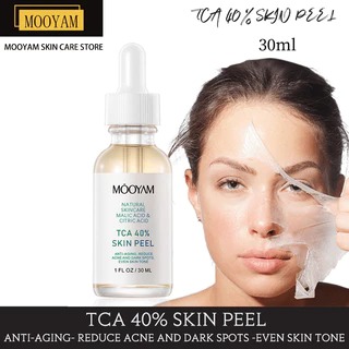 tca solution - Best Prices and Online Promos - Dec 2024 | Shopee ...