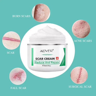 Aliver Scar Cream Old Scar Removal Gel Repair Stretch Marks, Pimple ...