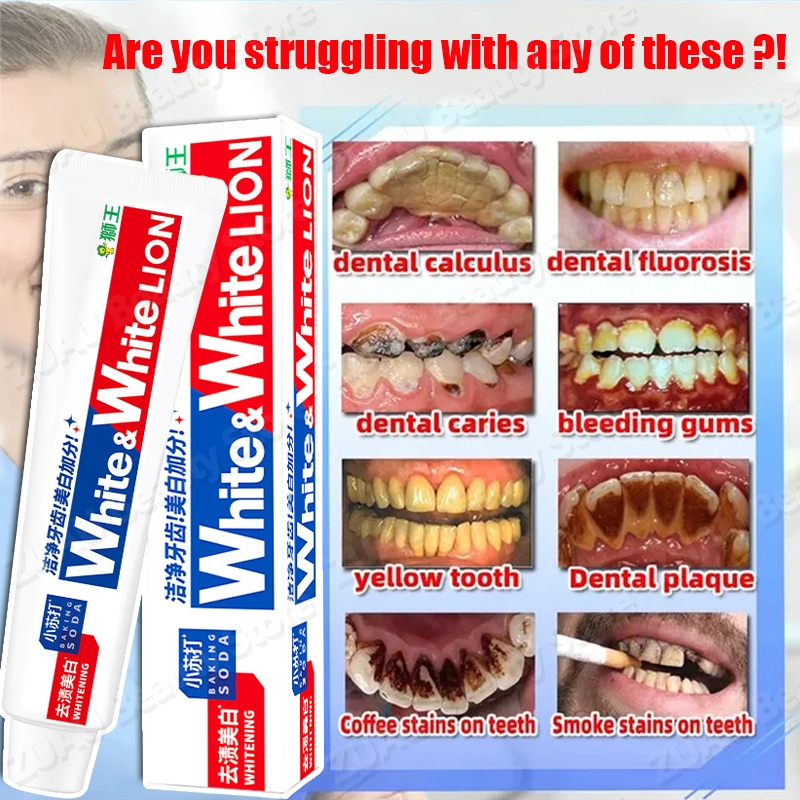 【BUY 1 TAKE 1】Baking Soda Whitening Toothpaste Peppermint Food Graded ...