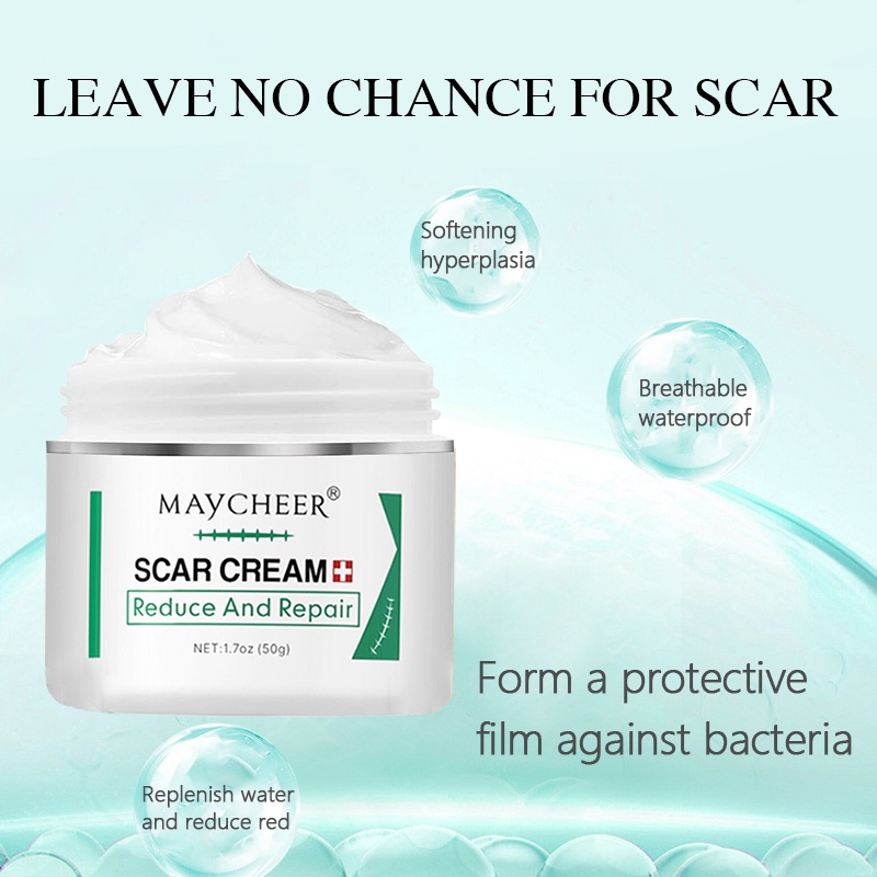 50g Scar Removal Cream Peklat Remover Acne Treatment Old Scar Remover ...