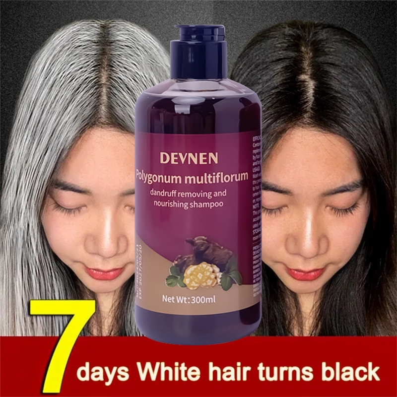 DEVNEN Natural Herbal White Hair Turns To Black Hair Shampoo Dandruff ...