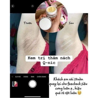 QNIC CARE UNDERARM CREAM (thailand) | Shopee Philippines