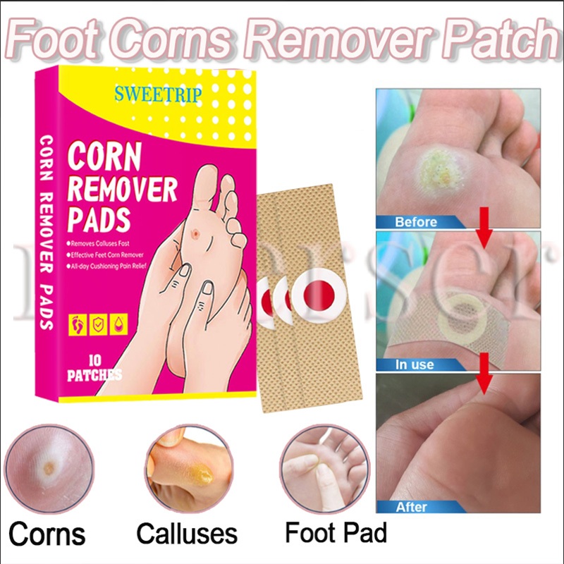 SWEETRIP Foot Corns Remover Patch Remove Calluses Plaster Skin Tag For ...