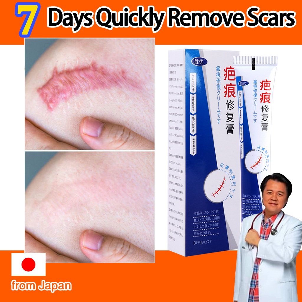 Scars Removal Cream Original For Old Scar On Leg Pampatanggal Ng Peklat ...