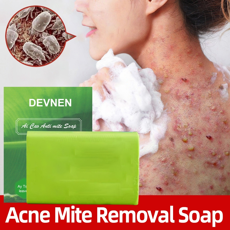 DEVNEN Wormwood Mite Removal Soap Whitening Remove Acne Anti Itching ...