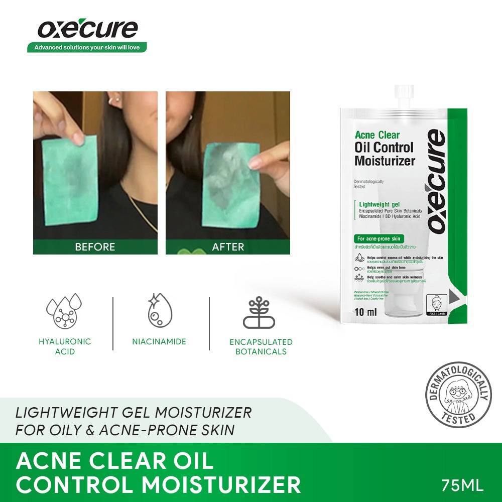 OXECURE Acne Clear Oil Control Moisturizer 10ml | Shopee Philippines
