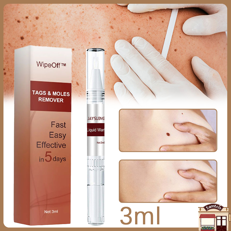 120Pcs/Box Warts Remover Patch and 3ml Moles Remover Pen Removal ...