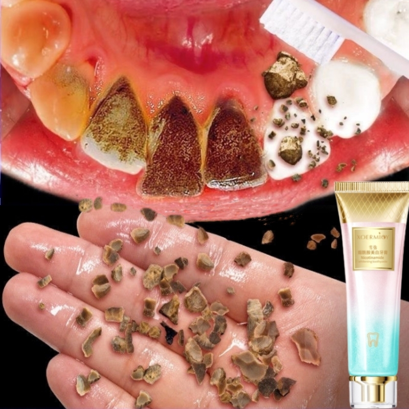 Aquacool niacinamide toothpaste whitening teeth yellow teeth tartar ...