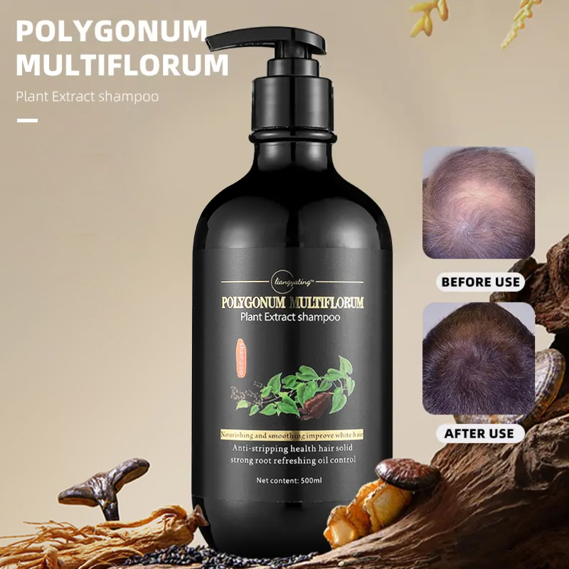 Pinipigilan ng Heshou U shampoo ang pagkawala ng buhok at maaaring ...