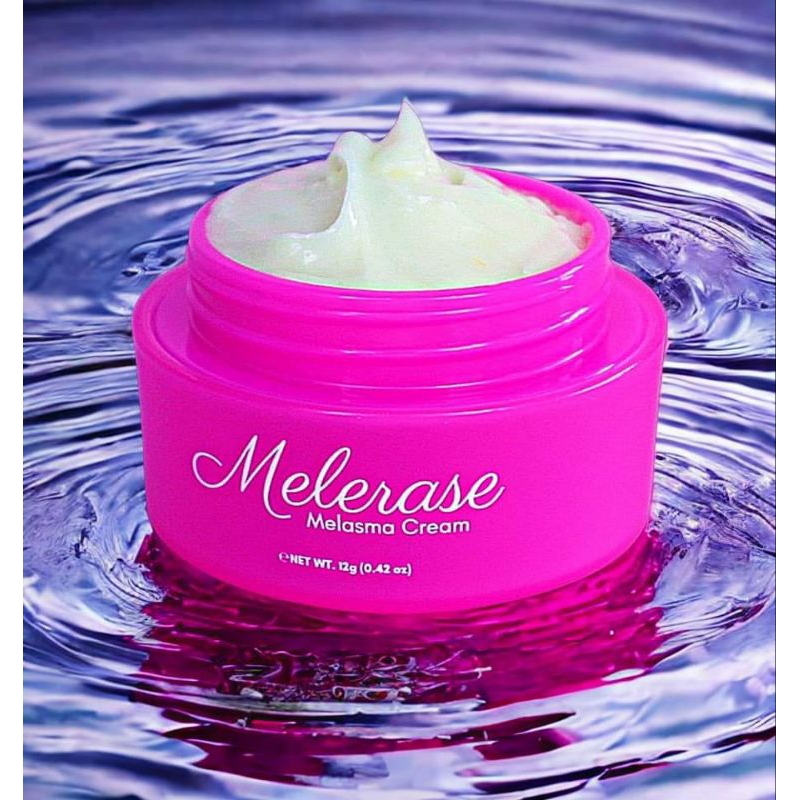 Authentic Acne Melasma and Pekas Remover Cream | Shopee Philippines