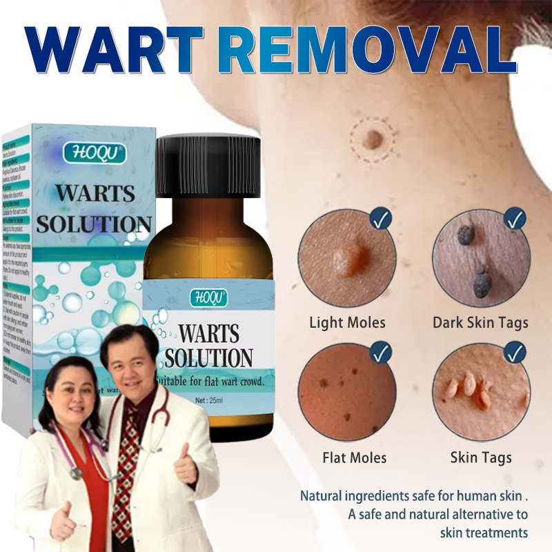 Warts Remover Original Kasoy Oil Private Parts Genital Wart Skin Tags ...