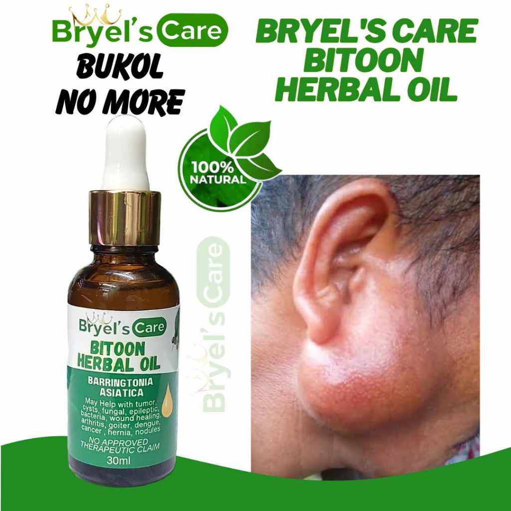ORIGINAL HERBAL OIL SA BUKOL/BITOON | Shopee Philippines