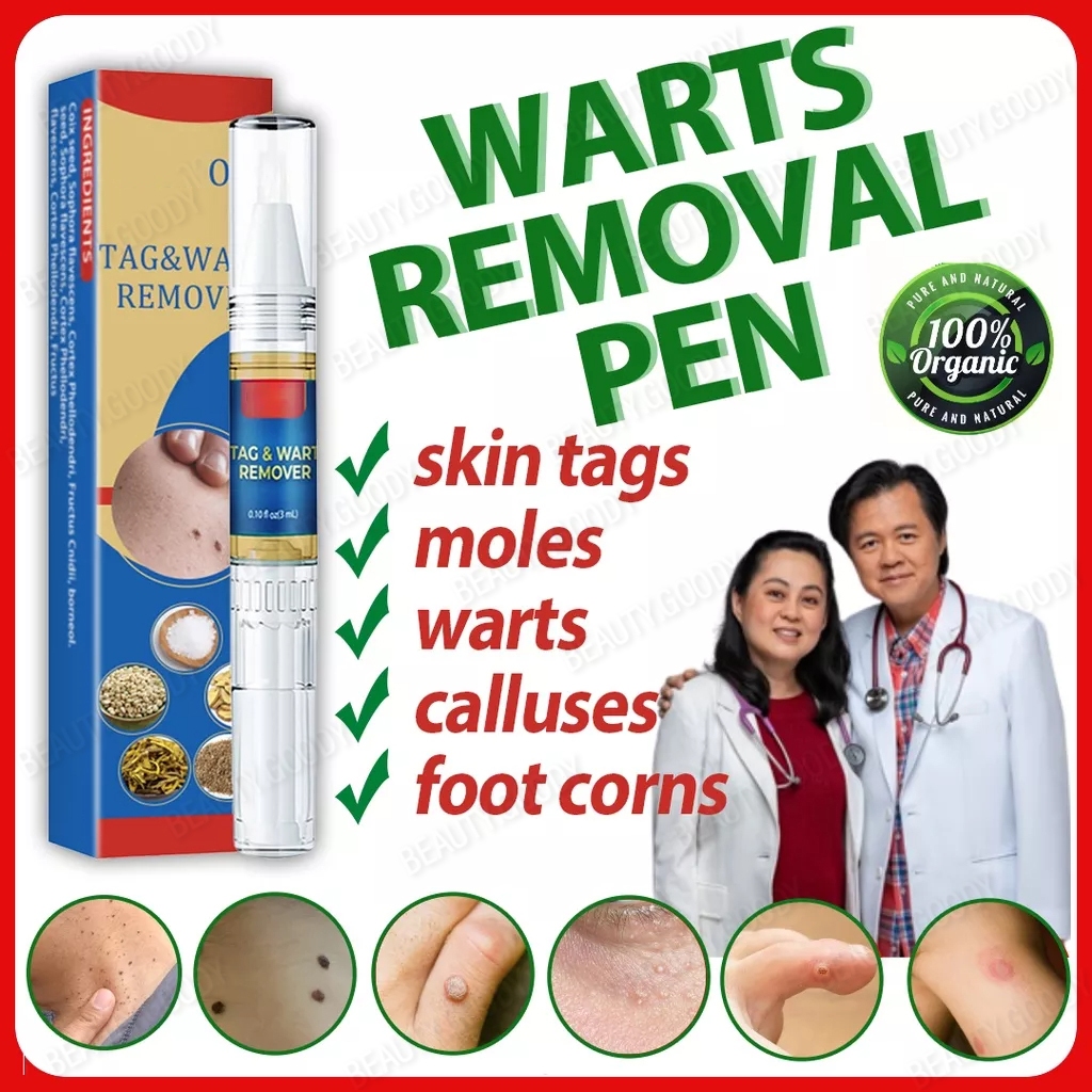 ORIGINAL Wart Remover Pen | Shopee Philippines