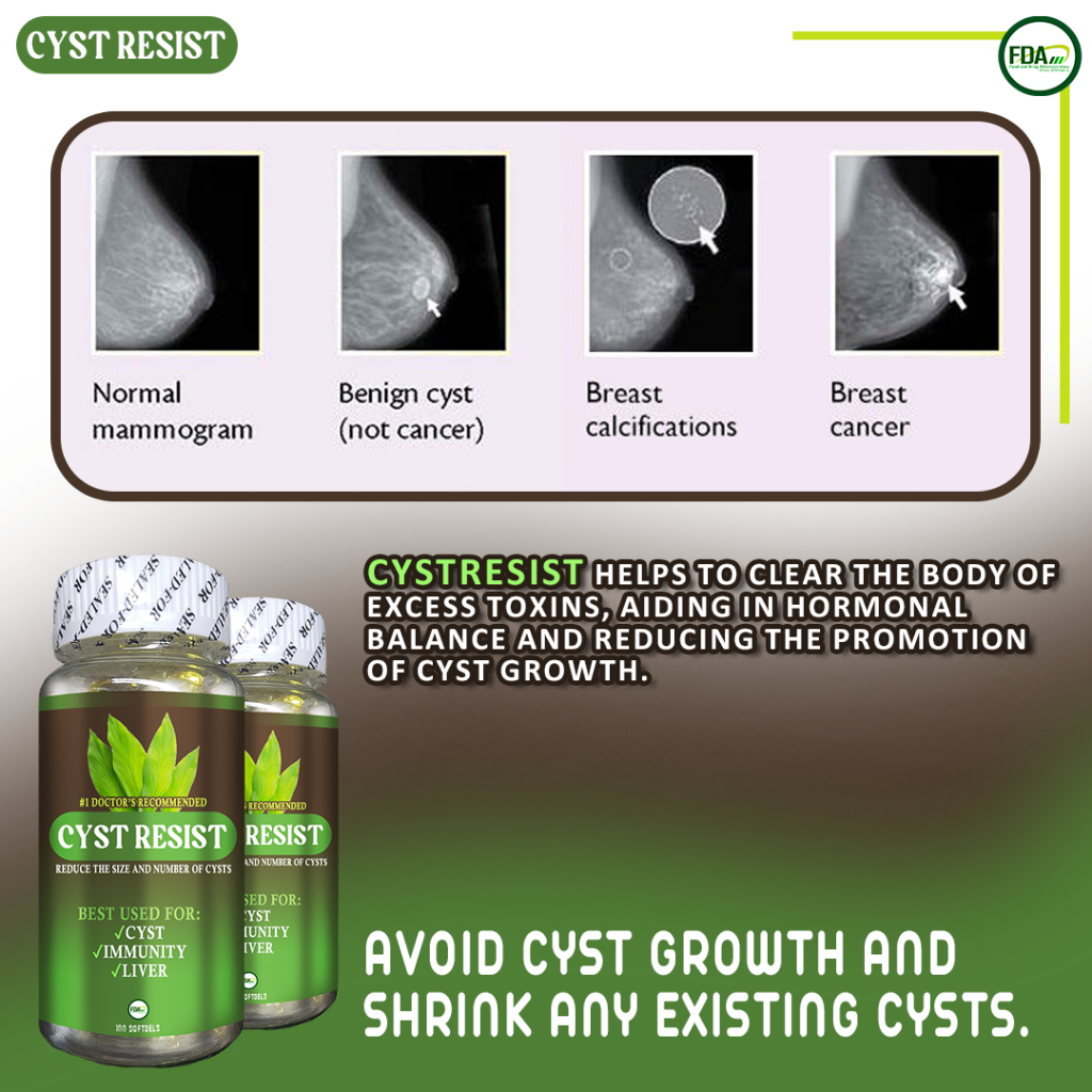 Cyst Resist -WE CURE CYSTS- Anti-Cyst, Anti-Bukol, Cyst Fighter instant ...