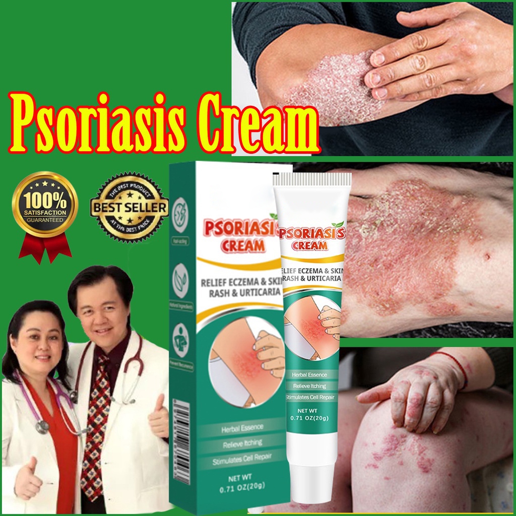 SENLOVE 20G Psoriasis Cream Eczema Ointment Antibacterial Anti Itching ...
