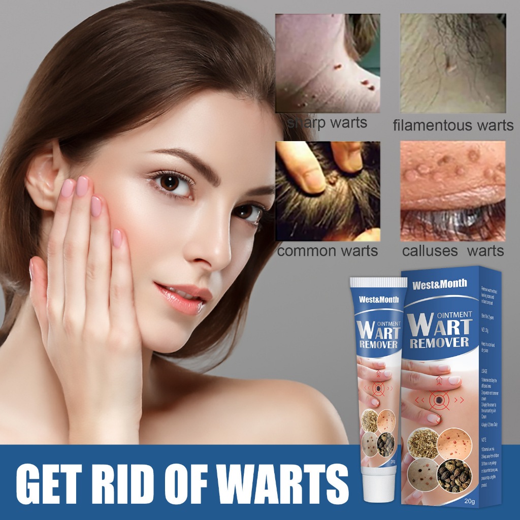 Wart Removal Ointment Wart Removal Cream Pimple Mark Removal Cream ...