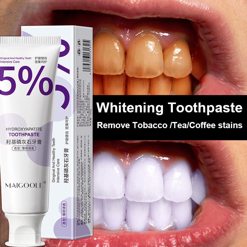 Whitening Toothpaste Whitening Teeth Fresh Breath Toothpaste Removing ...