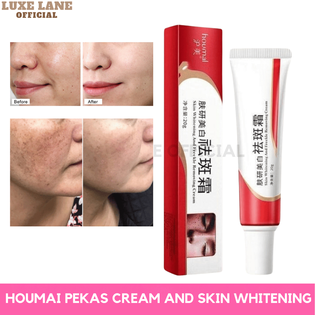 Pekas Remover Cream Whitening - Collagen Melasma Cream with Pekas ...