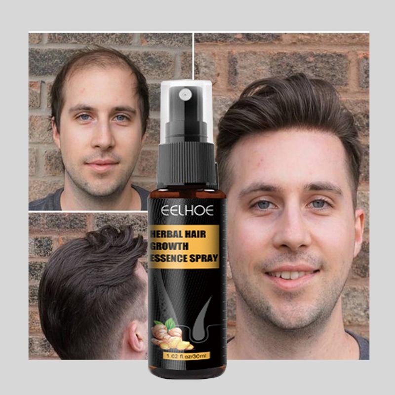 Fast Hair Growth Hair For Men Original Minoxidil Regrow Ginger Hair ...