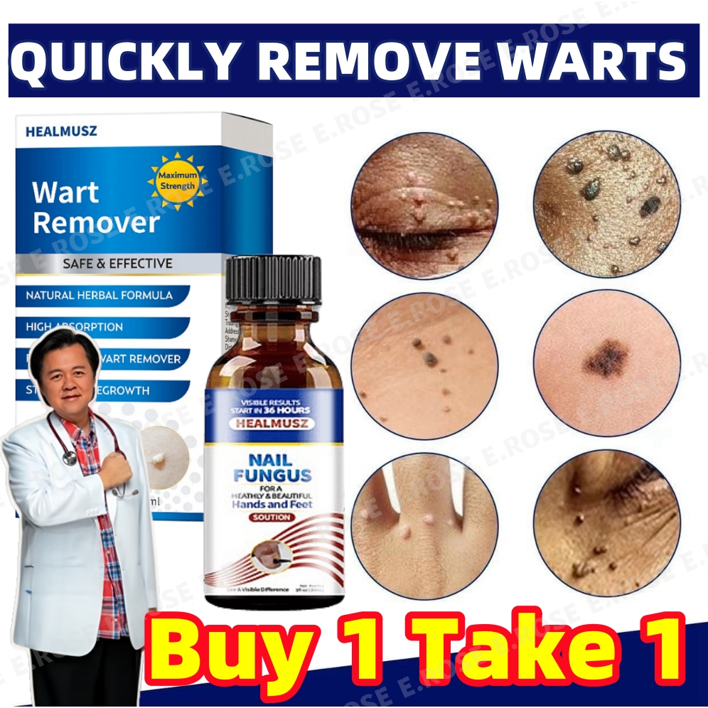 [BUY 1 TAKE 1] Warts Removal Original Cream Kulugo Skin Tags Mole ...