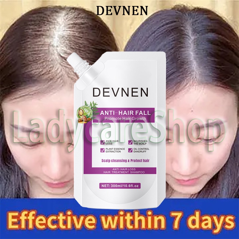 DEVNEN Ginger Hair Shampoo Anti Hair Loss Oil Control Fast Hair Grower ...
