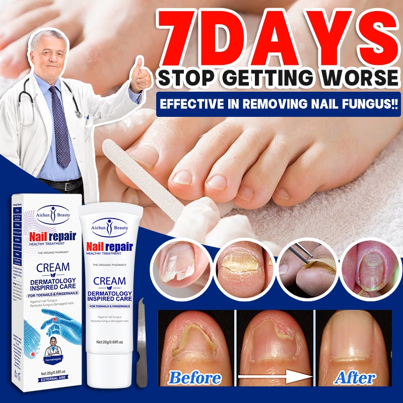 Aichun Nail Repair Cream 20g Nail Fungus Treatment Original Anti Fungal ...