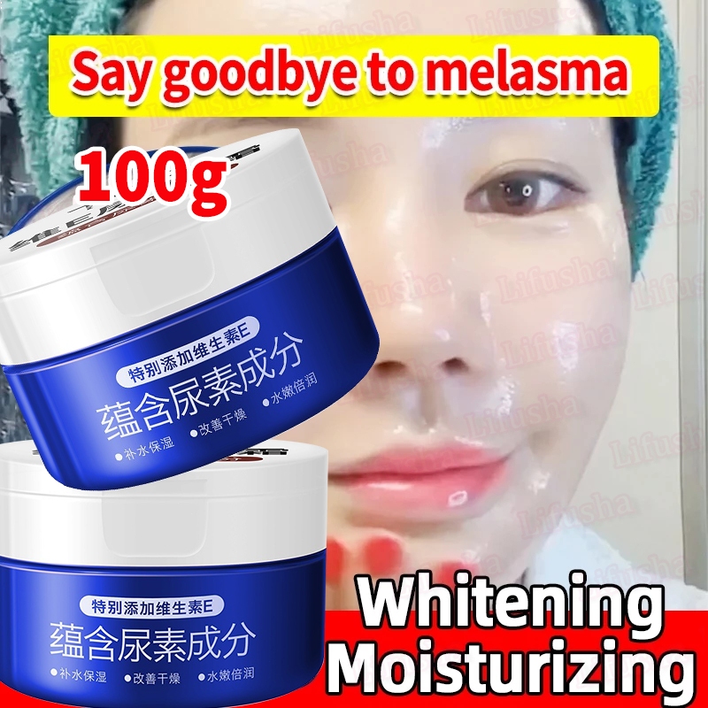 100g Melasma Cream Pekas Remover Lighten Dark Spot Whitening ...