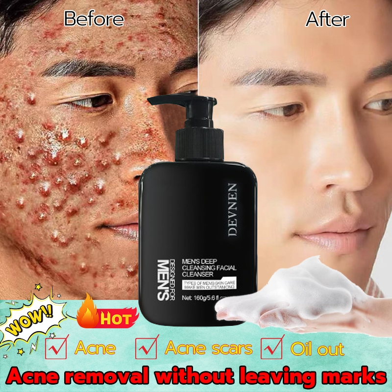DEVNEN Salicylic Acid Refreshing Facial Scrub Cleanser For Men Oil ...