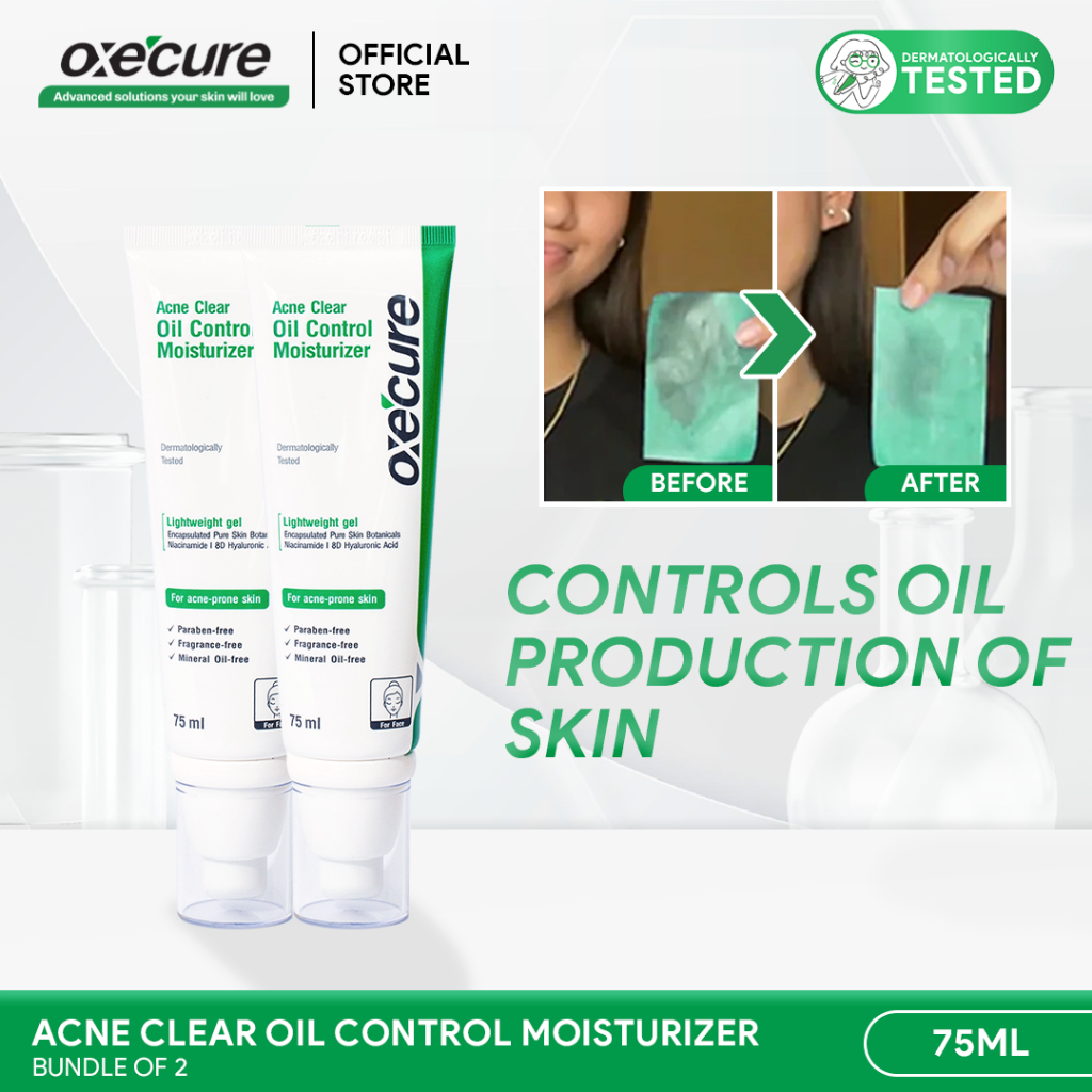 Oxecure Acne Clear Moisturizer 75ml Bundle of 2 | Shopee Philippines