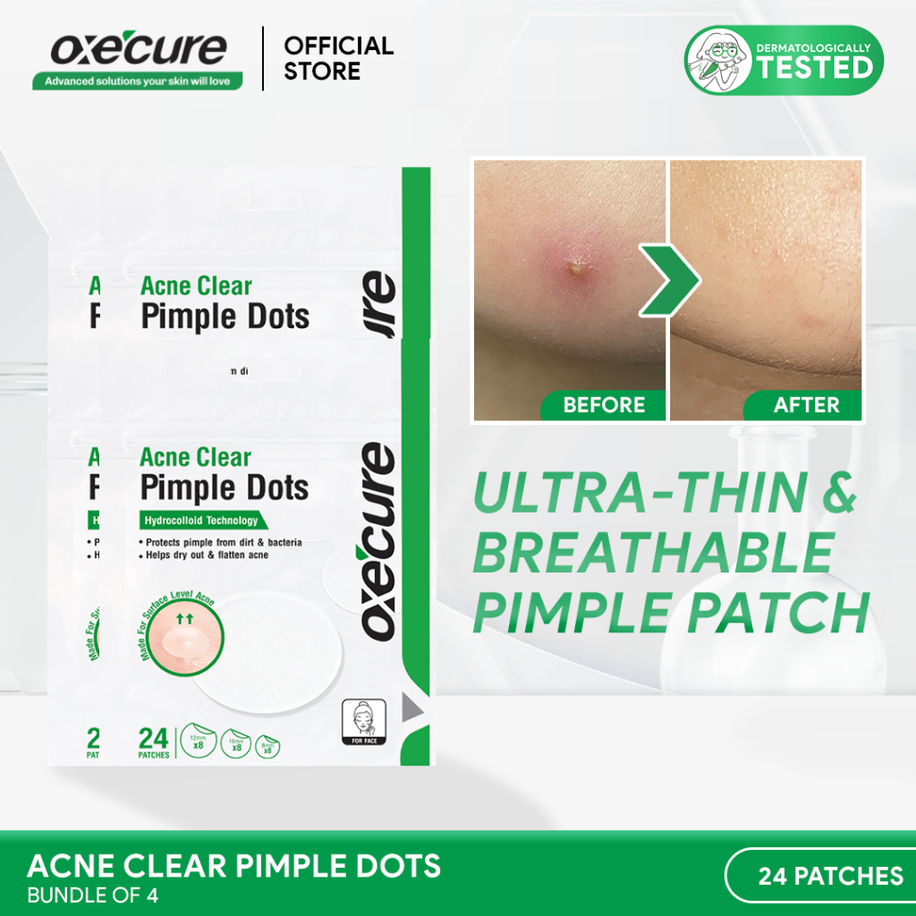 OXECURE Acne Clear Pimple Dots (24 patches) Bundle of 4 | Shopee ...